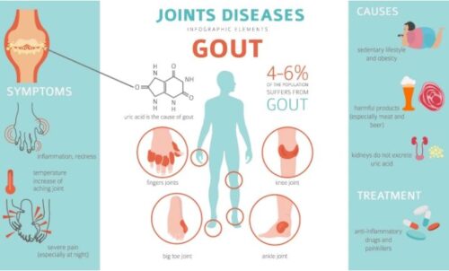 Gout - Aura Homeopathy